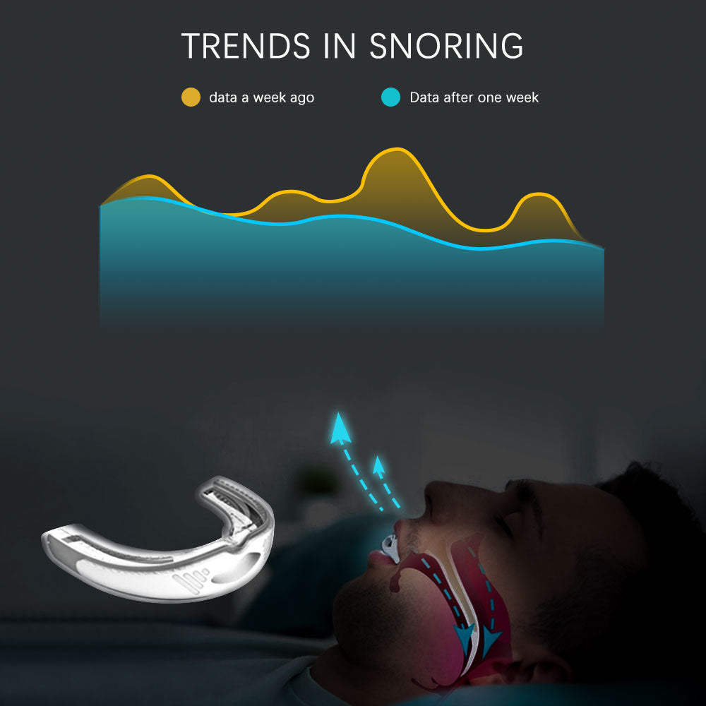 Anti-Snoring Mouth Night Guard – prime-supply-uk
